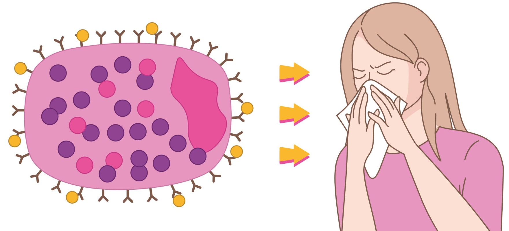 Аллергия на амброзию: всё о симптомах и лечении.